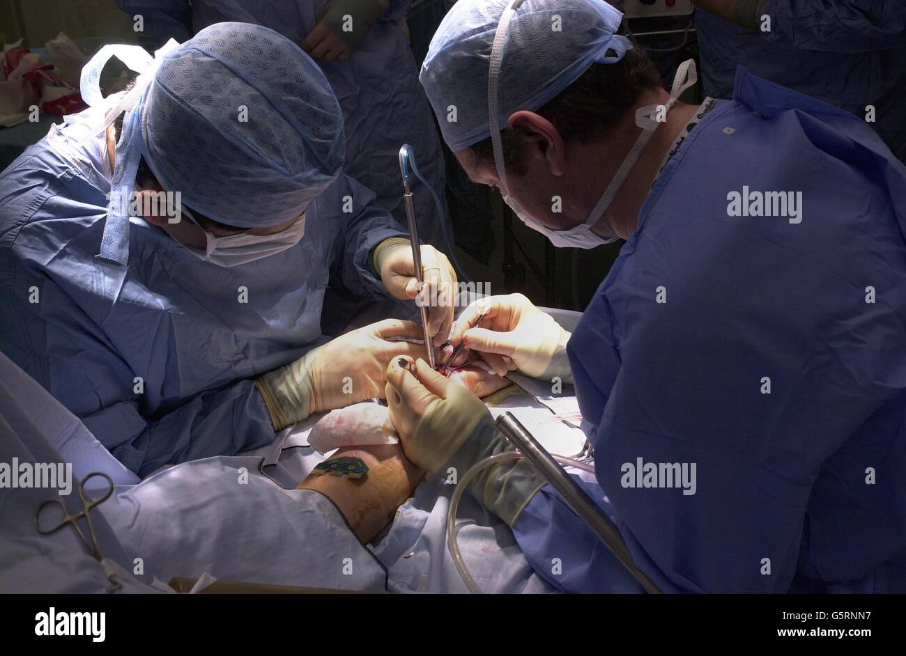 Worlds First Cyborg Part Human High Resolution Stock Photography and ...