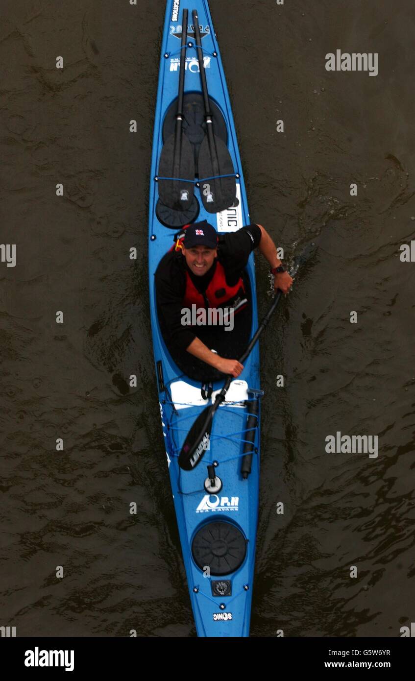 Amputee Nigel Rogoff during a photocall in London to promote the ...