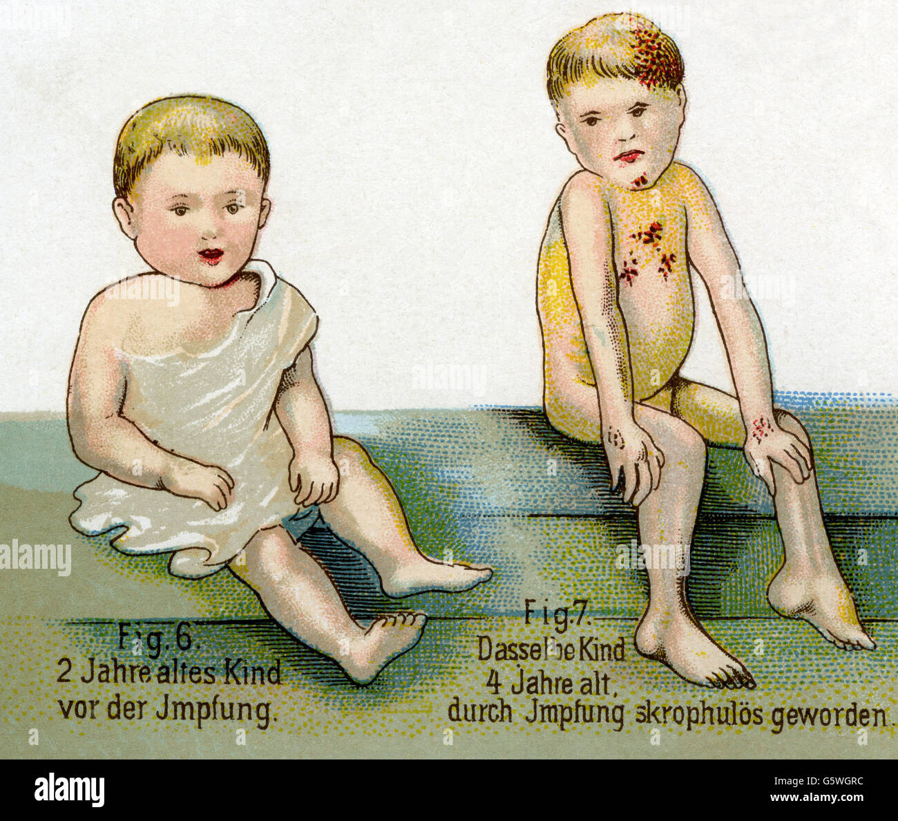 Scrofulous hi-res stock photography and images - Alamy