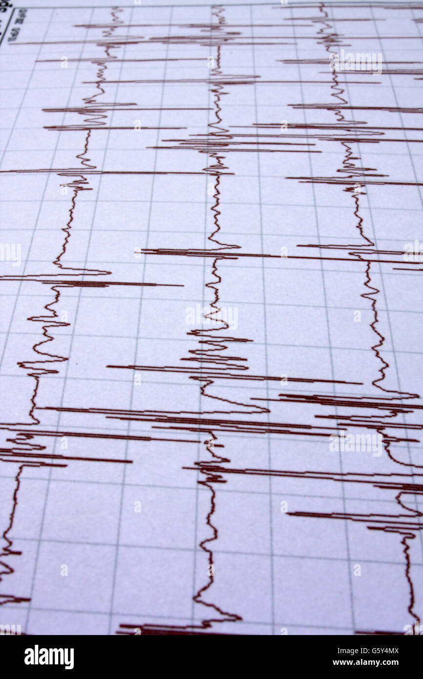 A cardiogram showing the waveform of heartbeats Stock Photo - Alamy