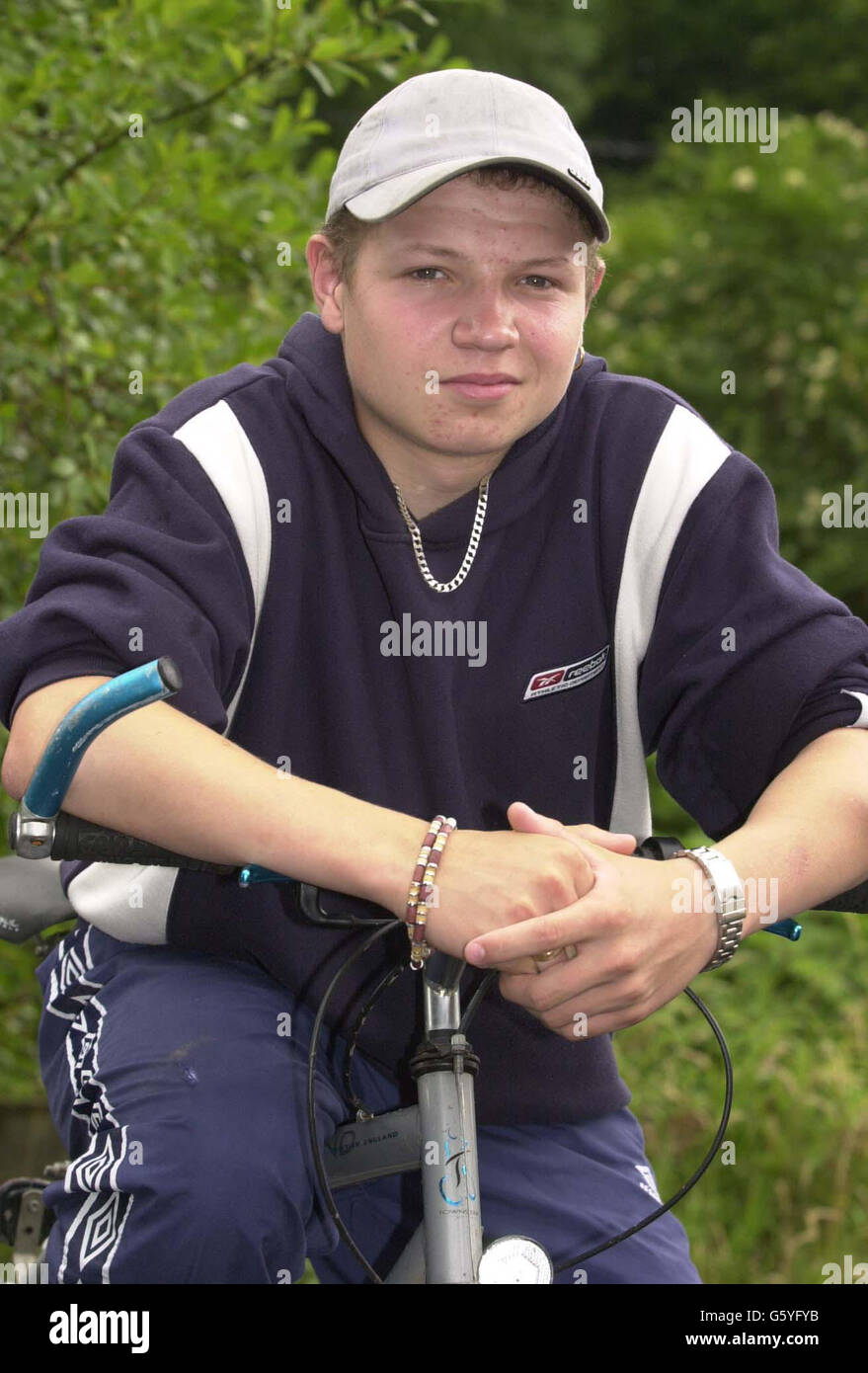 Kerion hi-res stock photography and images - Alamy