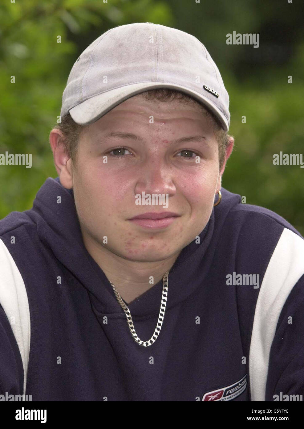 Kerion hi-res stock photography and images - Alamy