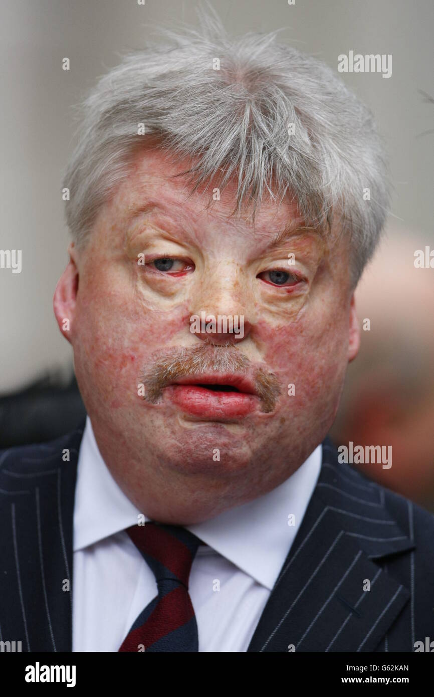 Simon Weston arrives for the funeral service of Baroness Thatcher, at ...
