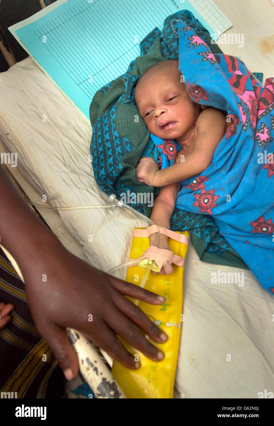 Baby starvation third world poverty health hi-res stock photography and ...