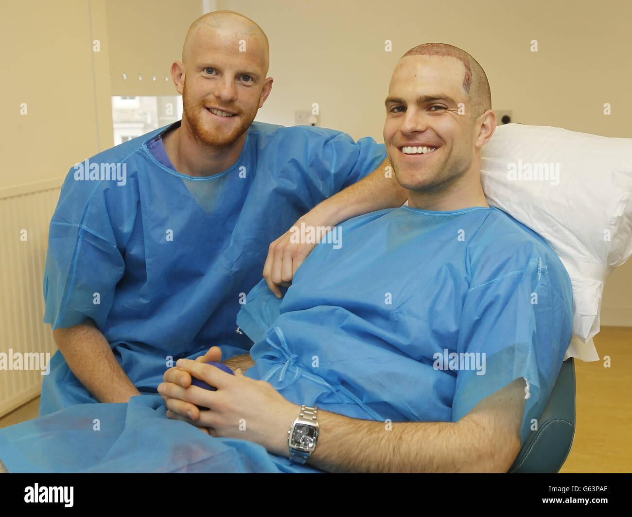Brothers Barry Cowan (left) and Brian Cowan, after undergoing a FUE ...