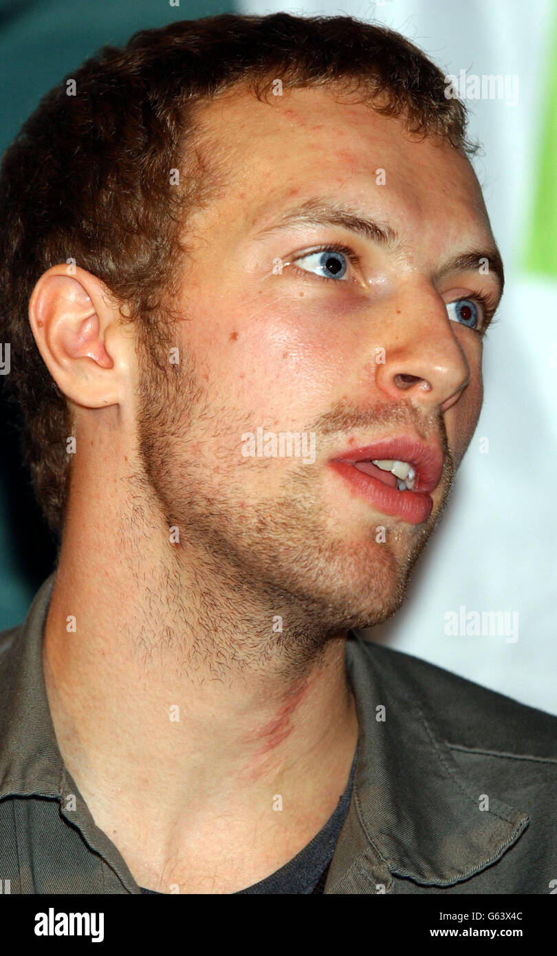 Coldplay's Chris Martin during a press conference before a concert ...