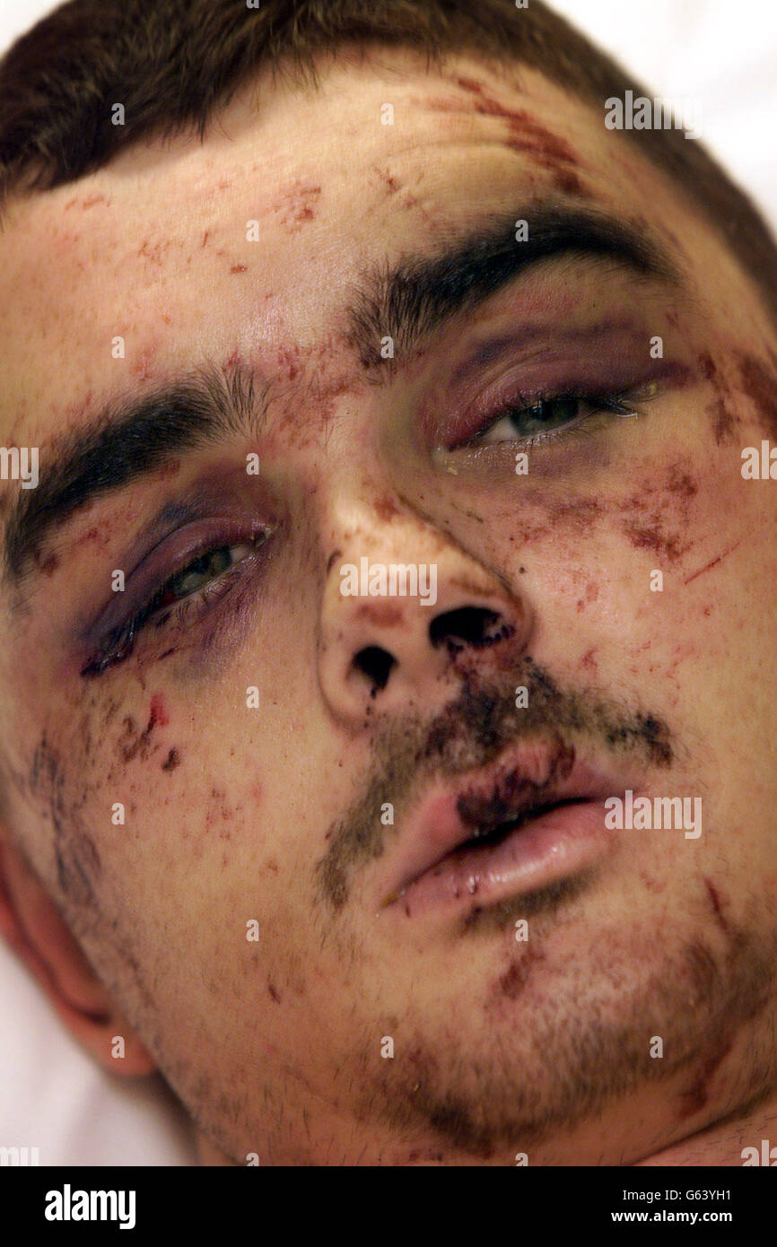 Mouth attack graphic hi-res stock photography and images - Alamy