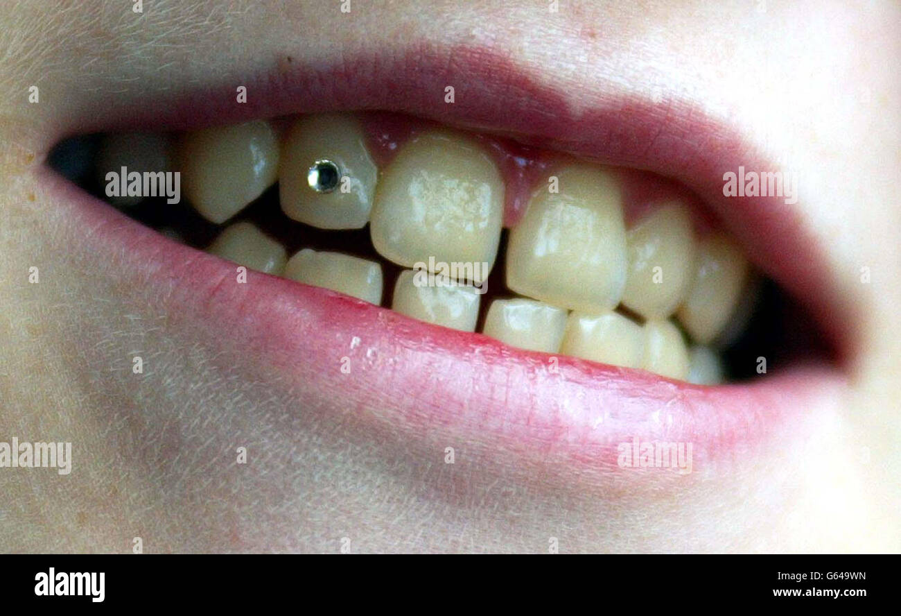 Rebecca read tooth gem hi-res stock photography and images - Alamy