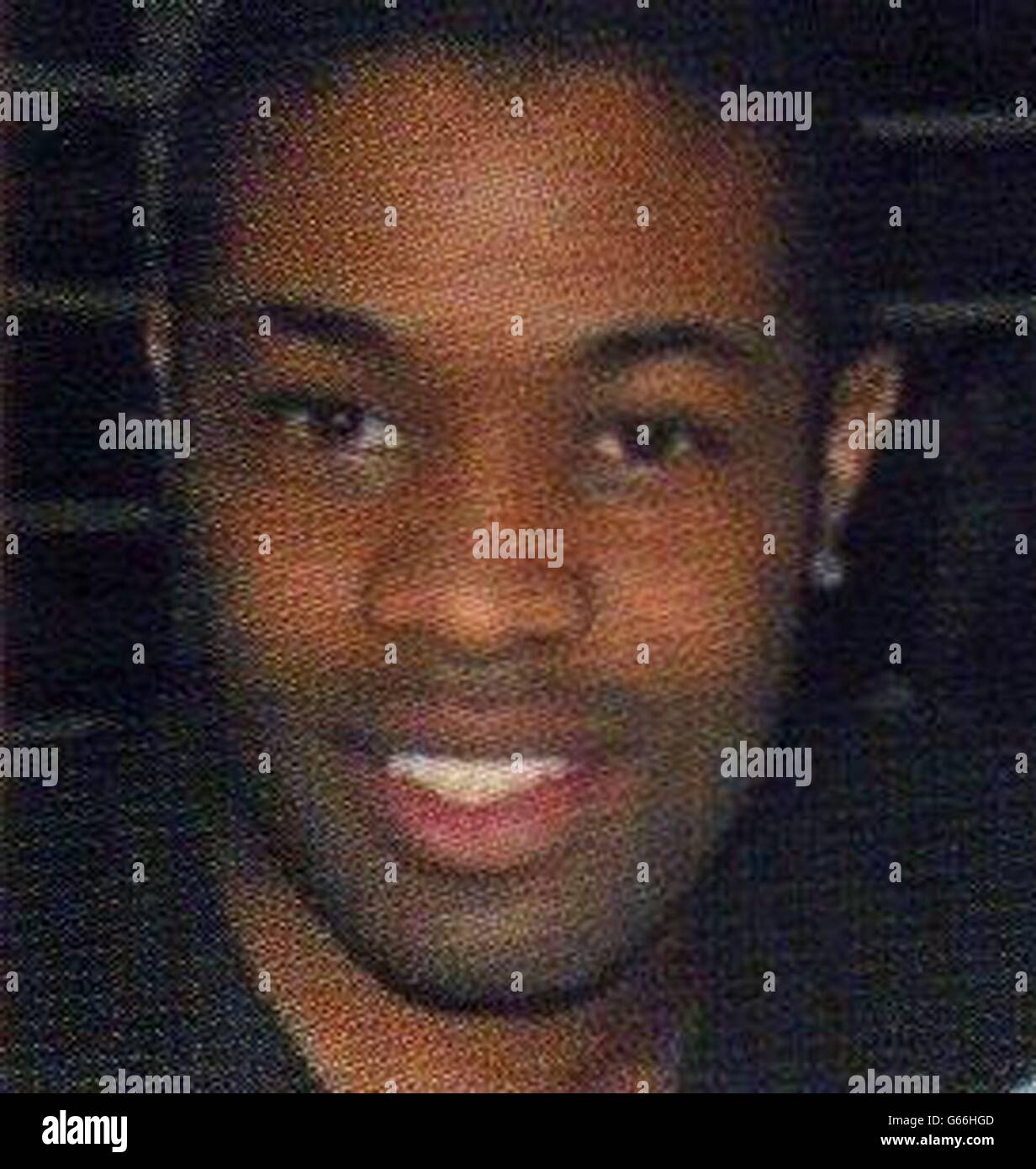 Stab wound abdomen hi-res stock photography and images - Alamy