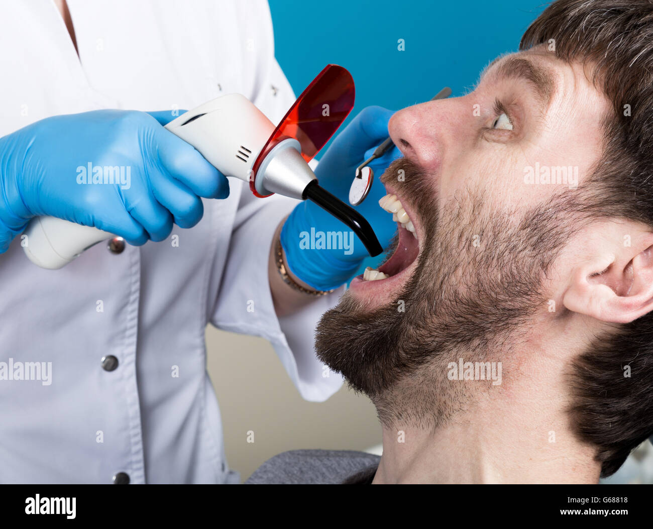 Doctor examines the oral cavity on tooth decay. Caries protection ...
