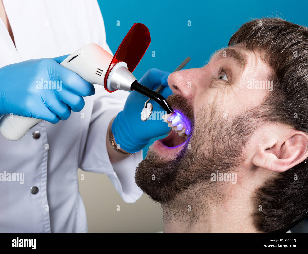 Doctor examines the oral cavity on tooth decay. Caries protection ...