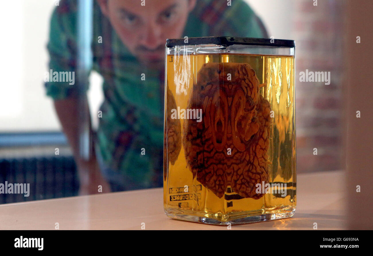 A man looks at a brain in a jar at the Museum of Science and Industry ...