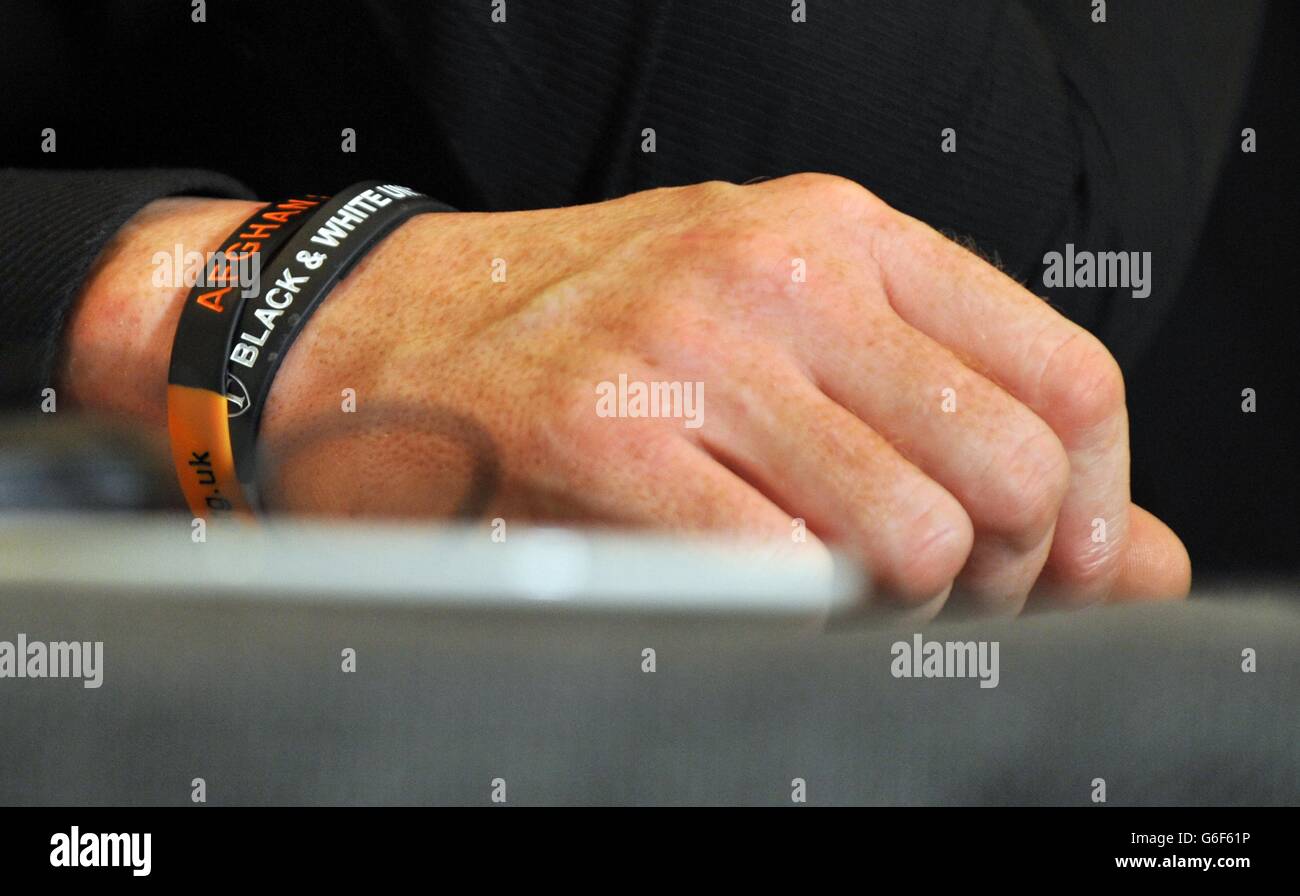 Bands on the wrist of English Defence League (EDL) co-founder Kevin ...