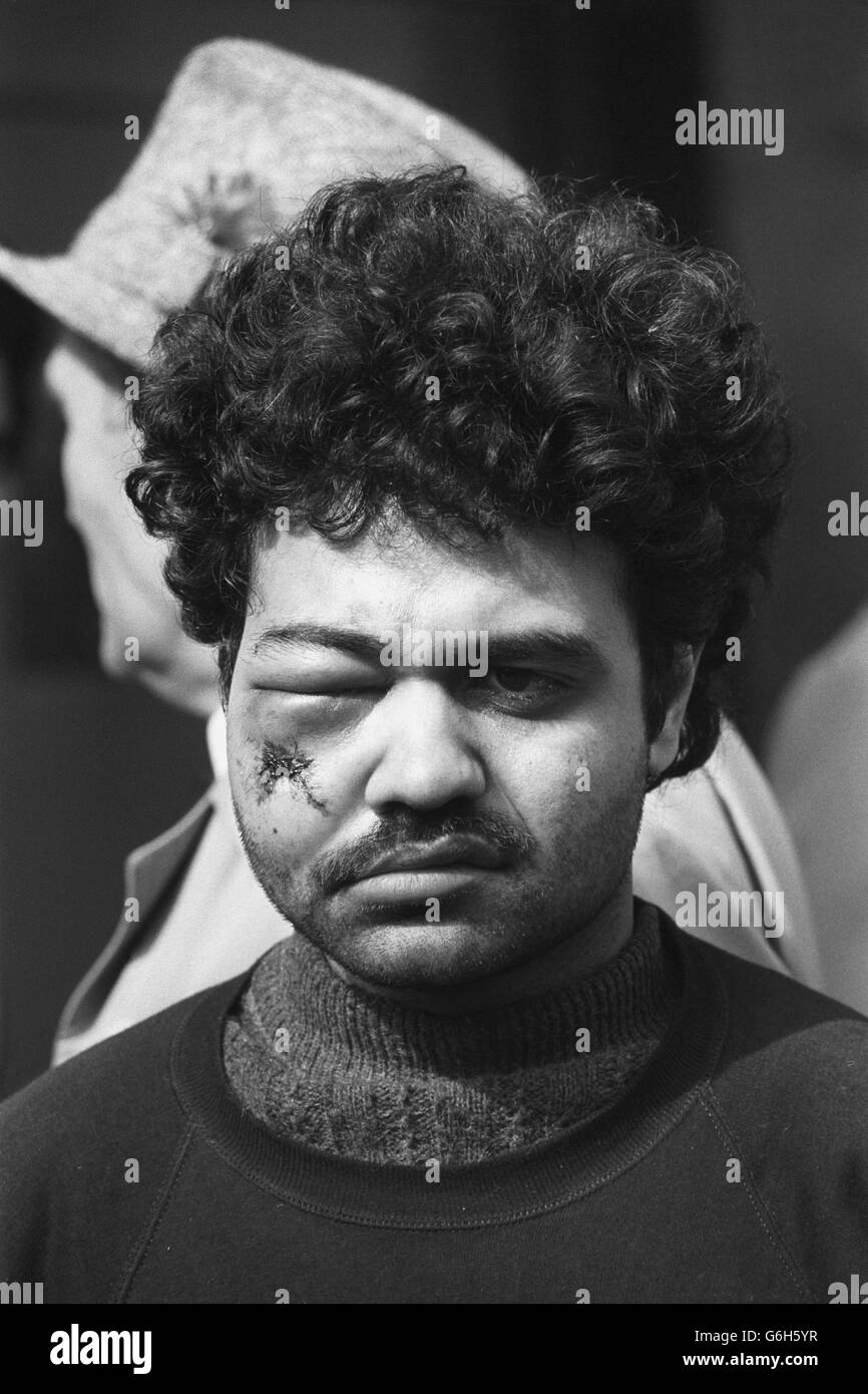 His right eye badly bruised and his cheek gashed, Sulil Sinha, 24, one ...