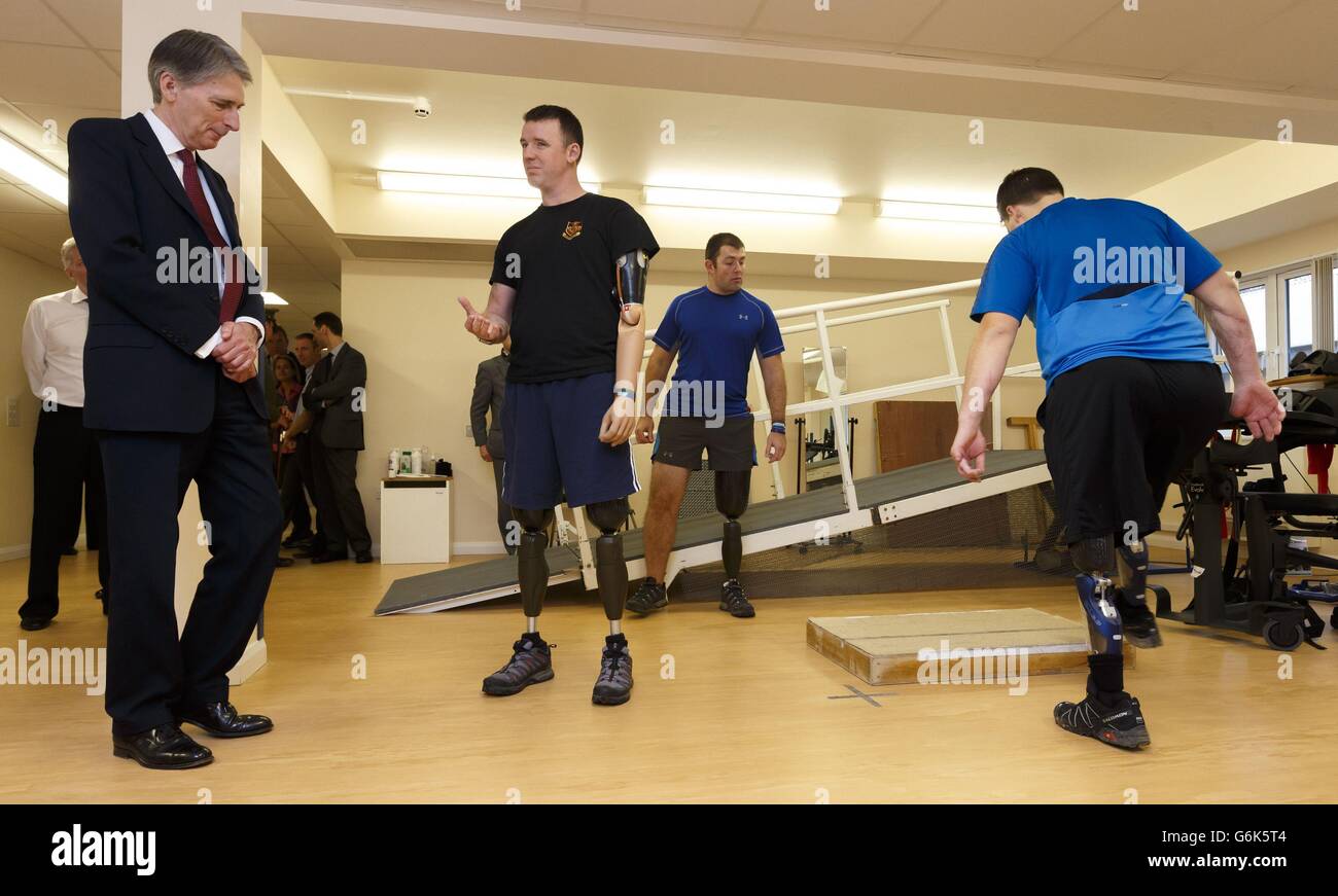Bionic legs for wounded service personnel Stock Photo - Alamy