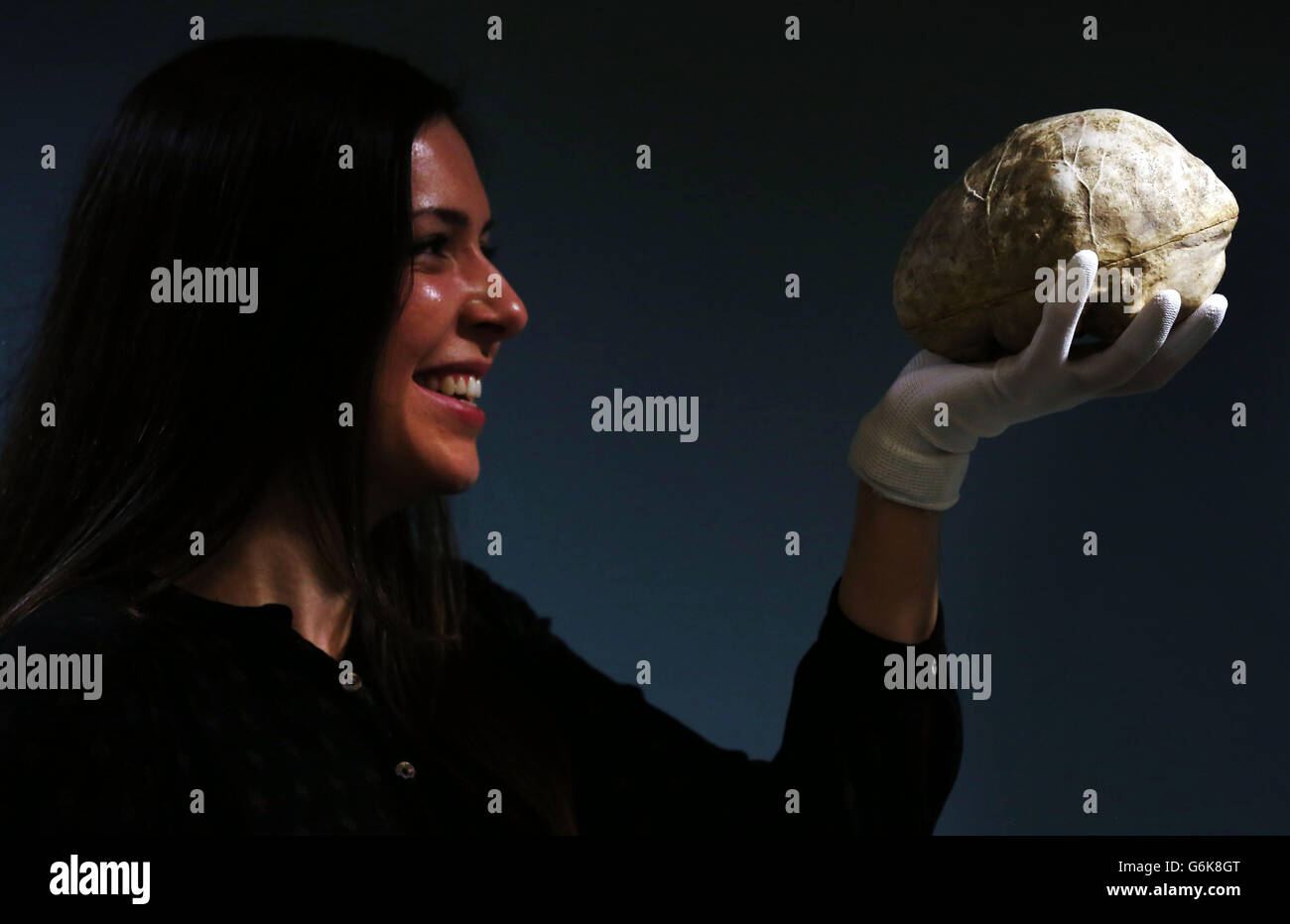 A cast of body snatcher William Burk's brain held by staff member Emma ...