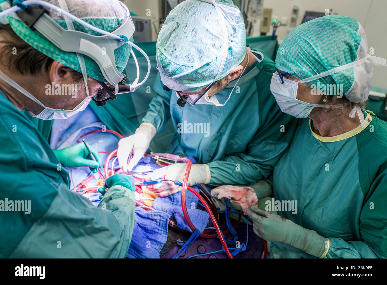 Heart surgeons and operating room nurse during a heart valve operation ...