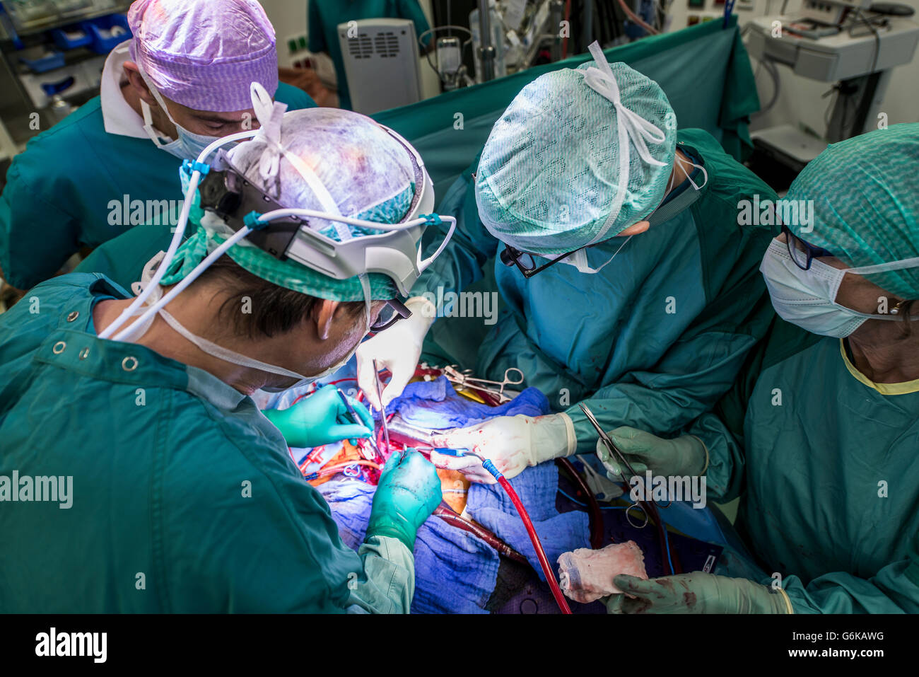 Heart surgeons and operating room nurse during a heart valve operation ...