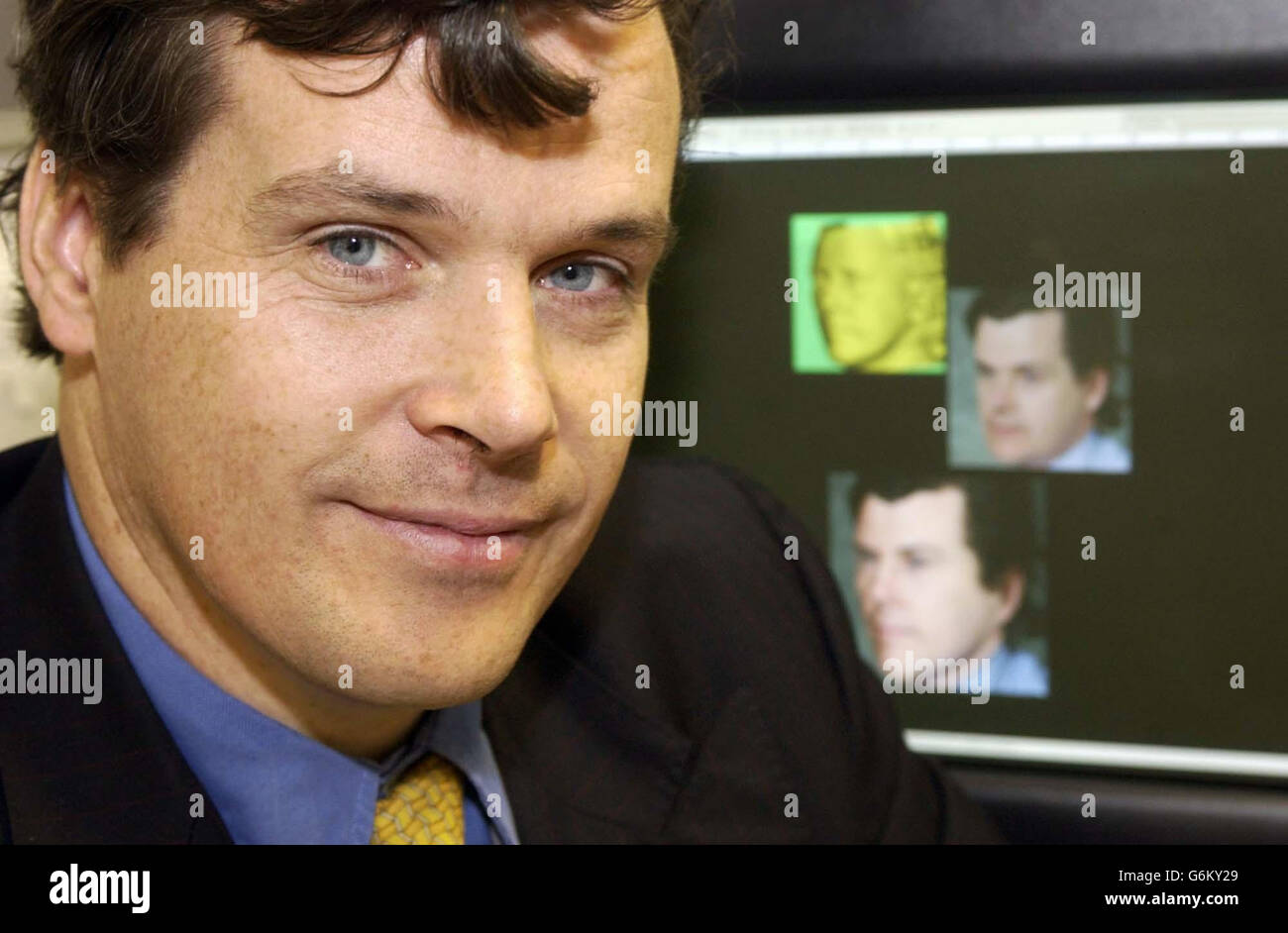 Face transplants hi-res stock photography and images - Alamy