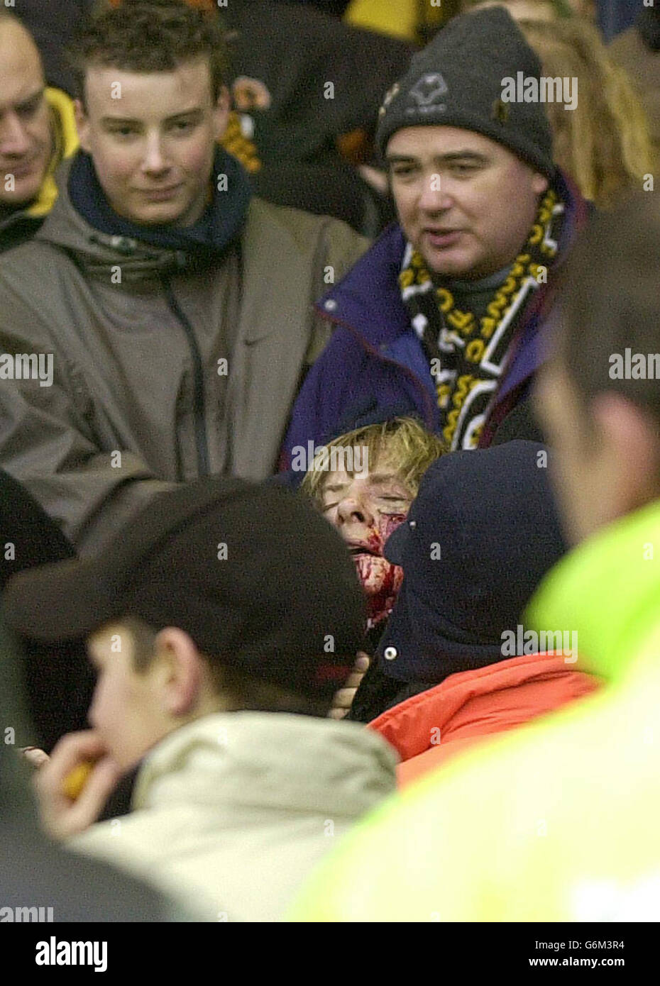 A female Wolves fan is carried from the crowd after being injured by a ...