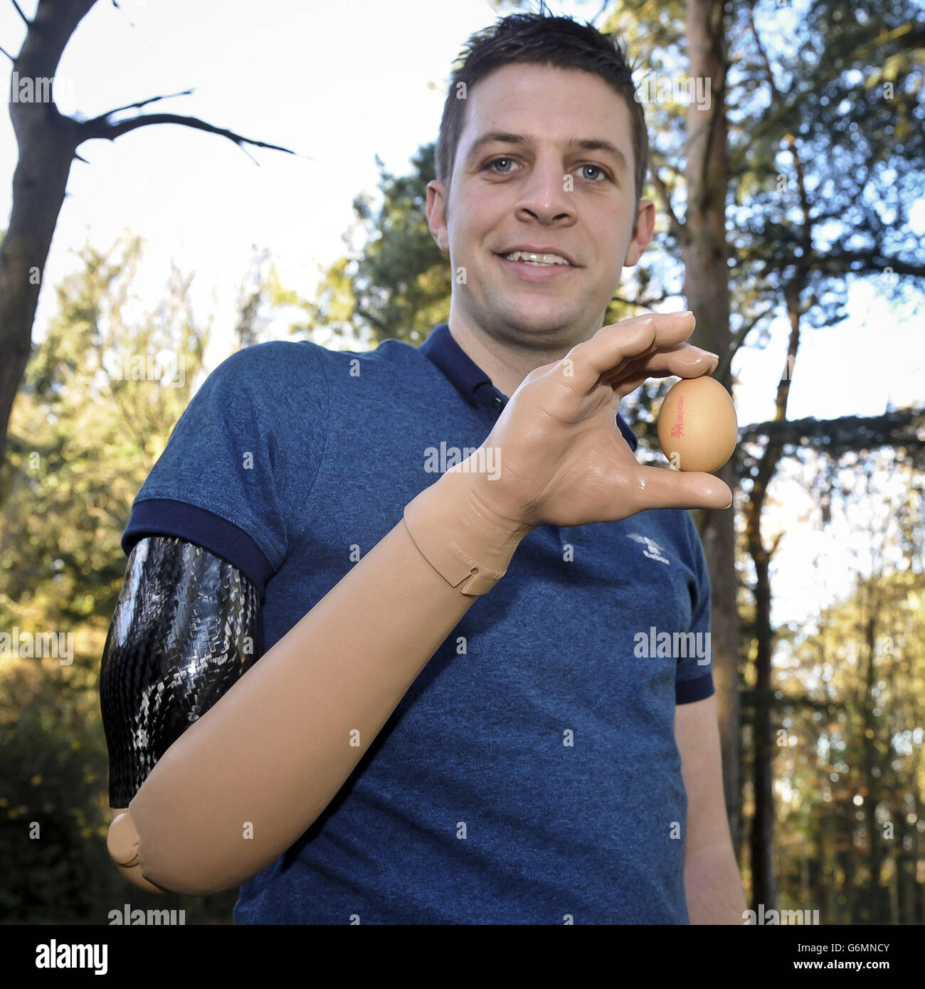 Prosthetic arm hi-res stock photography and images - Alamy