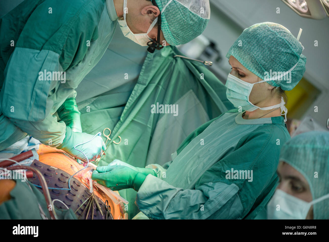 Heart surgeons during a heart operation Stock Photo - Alamy