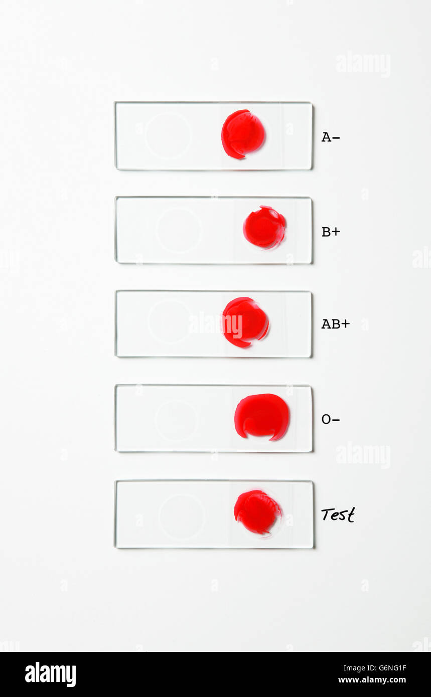 RH blood test isolated on white. Vertical format Stock Photo - Alamy