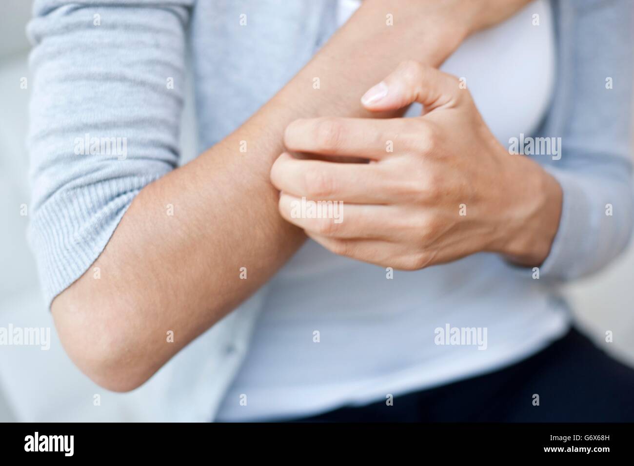 MODEL RELEASED. Woman scratching her arm, close up Stock Photo - Alamy
