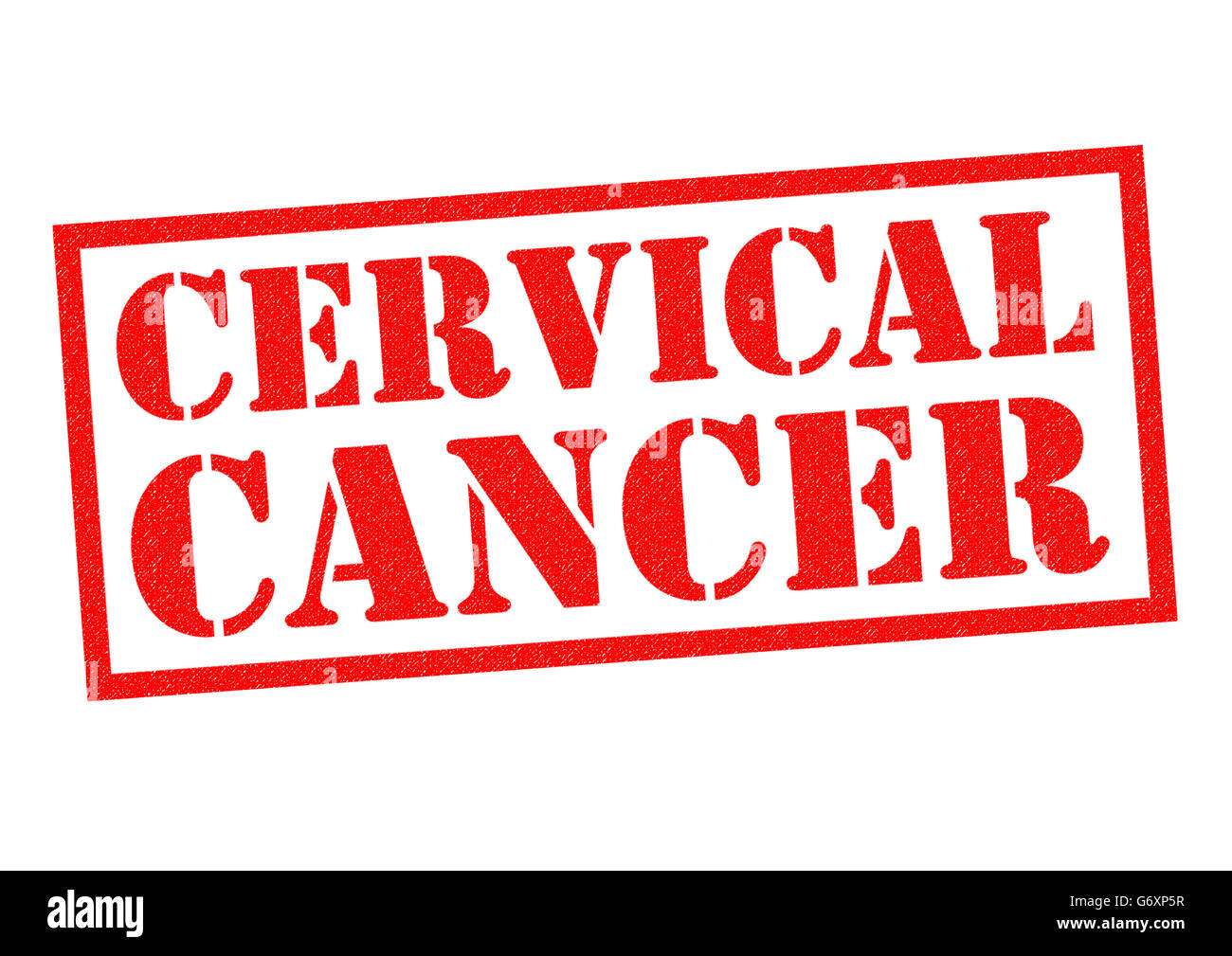 Cervical cancer hi-res stock photography and images - Alamy
