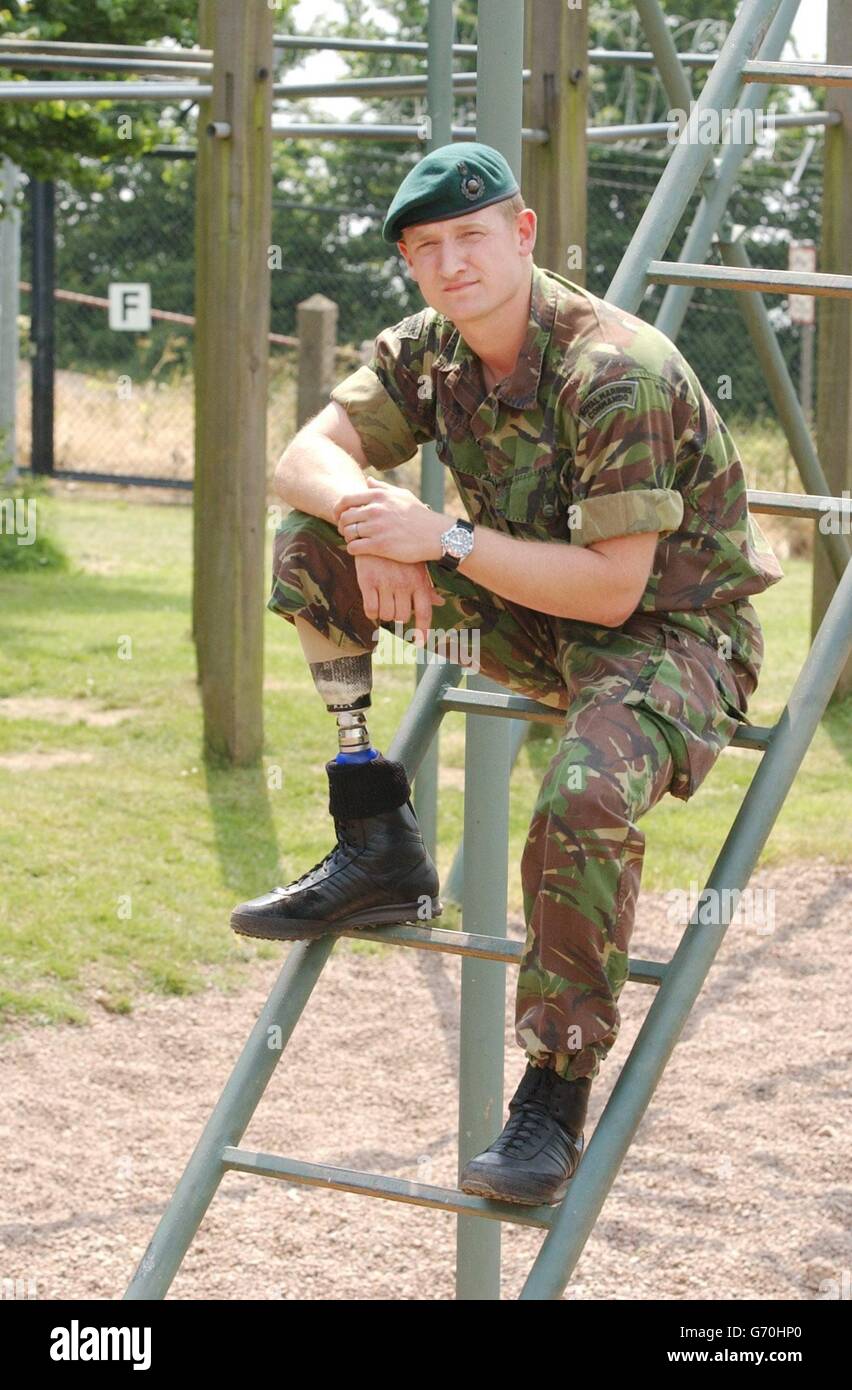 Below Knee Amputee High Resolution Stock Photography and Images - Alamy