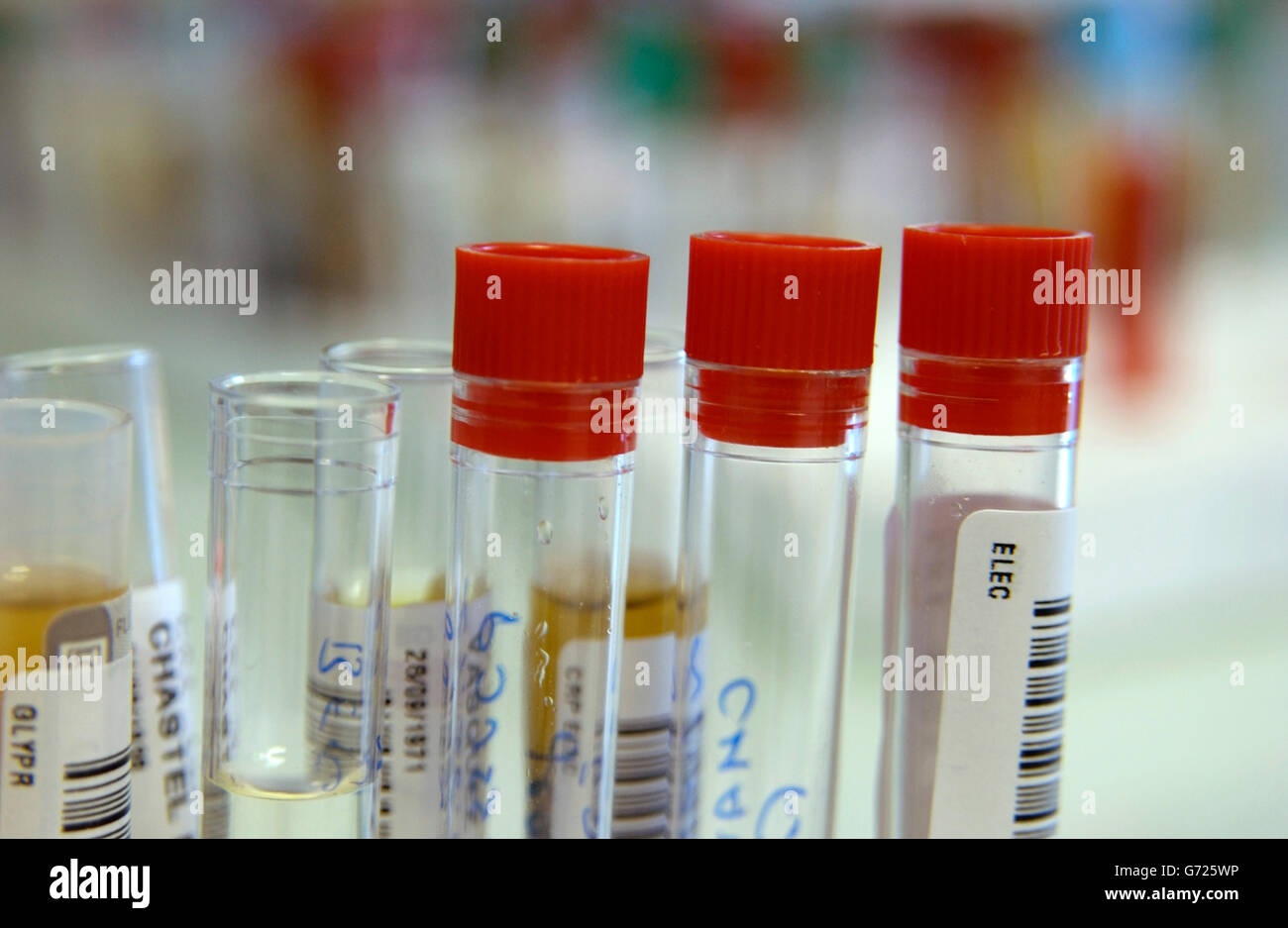 Test tubes in a laboratory Stock Photo - Alamy