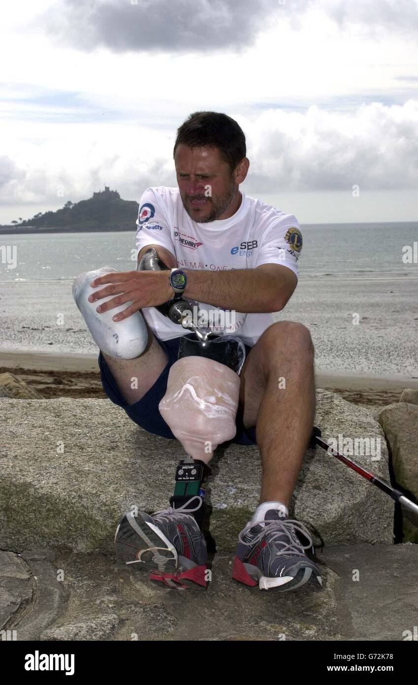 Landmine victim chris moon hi-res stock photography and images - Alamy