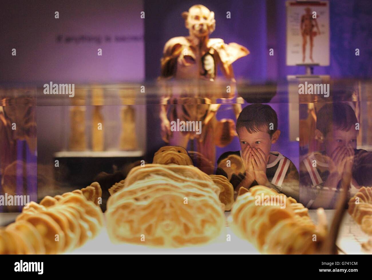 Dissected human hi-res stock photography and images - Alamy