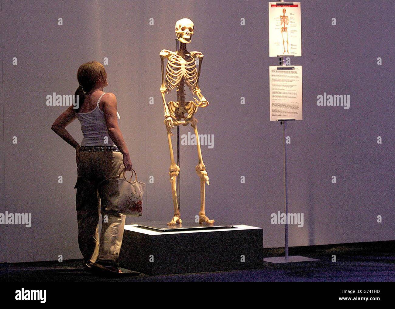 Dissected human bodies hi-res stock photography and images - Alamy