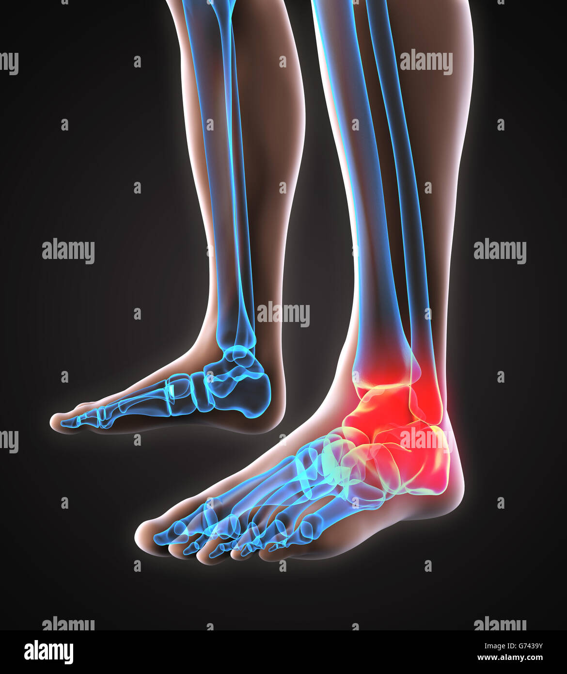 Ankle cartilage hi-res stock photography and images - Alamy