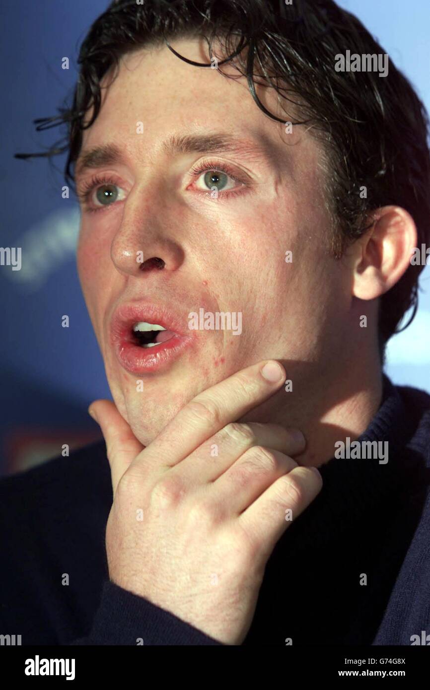 Hand on head sport football robbie fowler hi-res stock photography and ...
