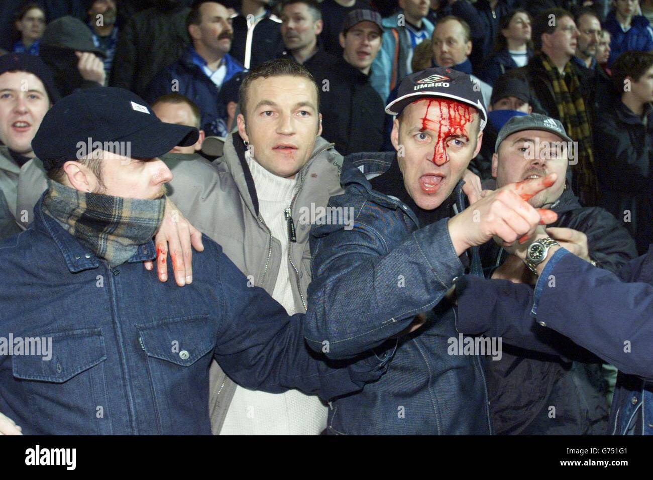 Football action fan injury blood hi-res stock photography and images ...