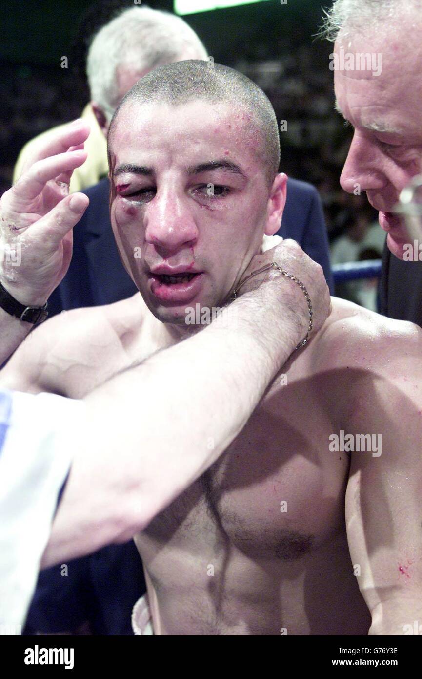 Manchester's Michael Brodie has his battered face looked at by his ...