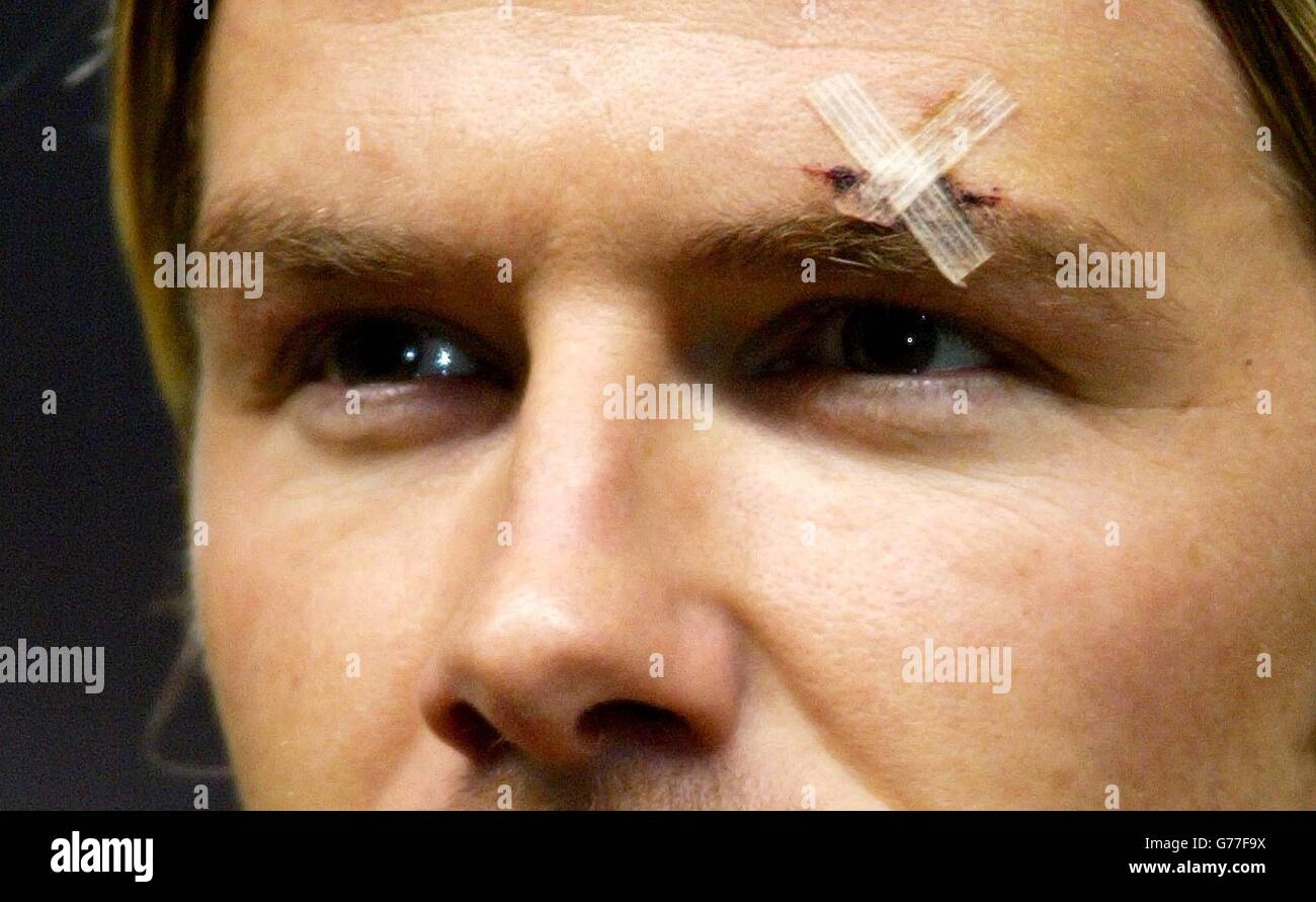 A plaster is visible over the injured left eyebrow of Manchester United ...