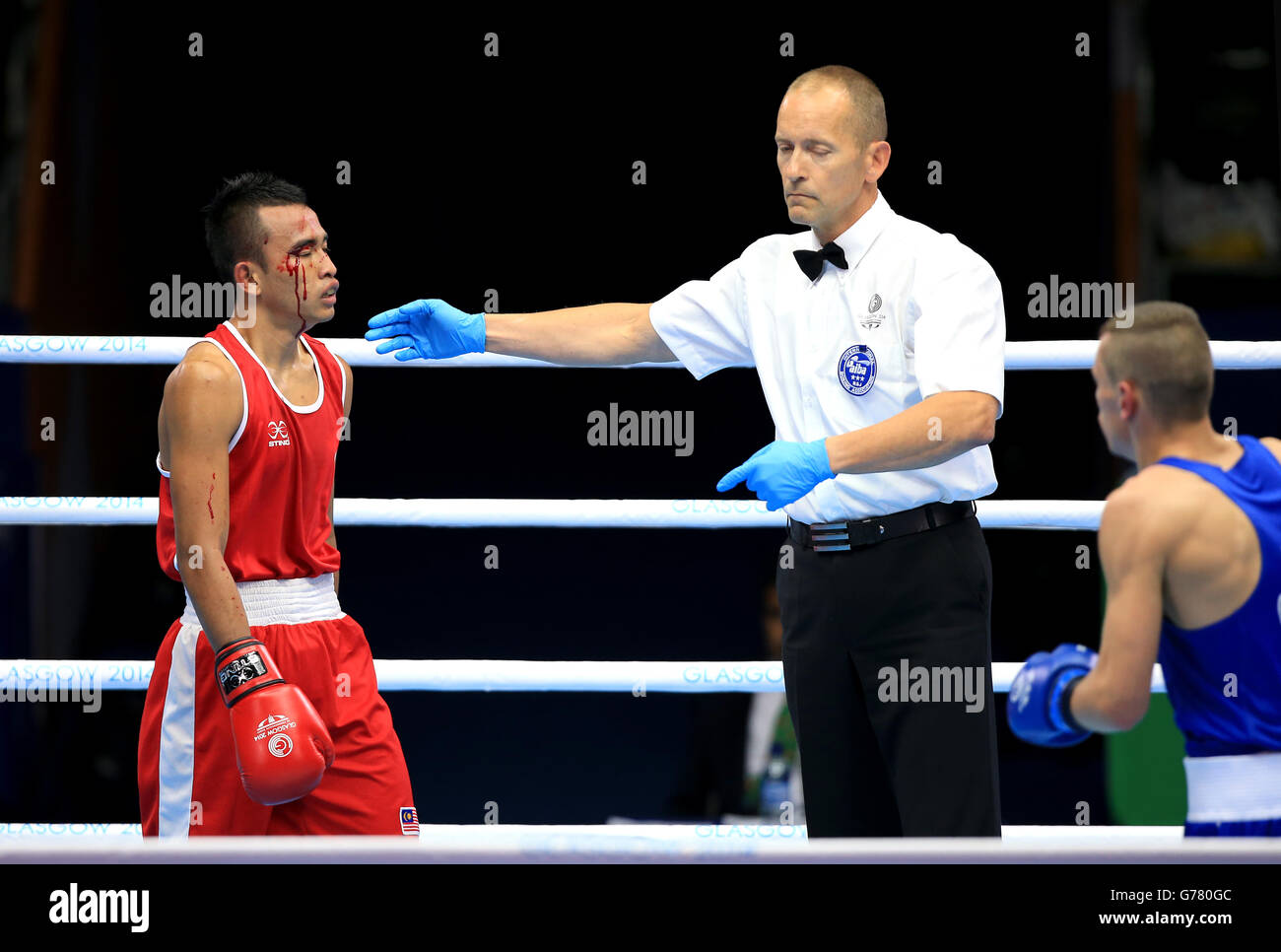 Malaysia's Muhammad Alnazirul Othman bleeds in his match against ...