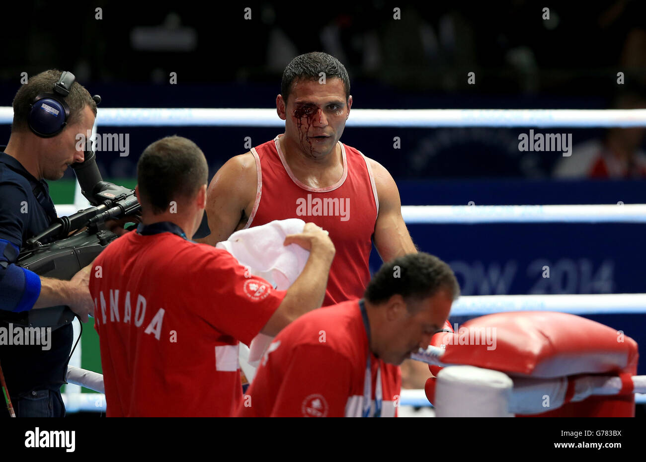 Canada's Samir El-Mais with a bloodied face against England's Warren ...