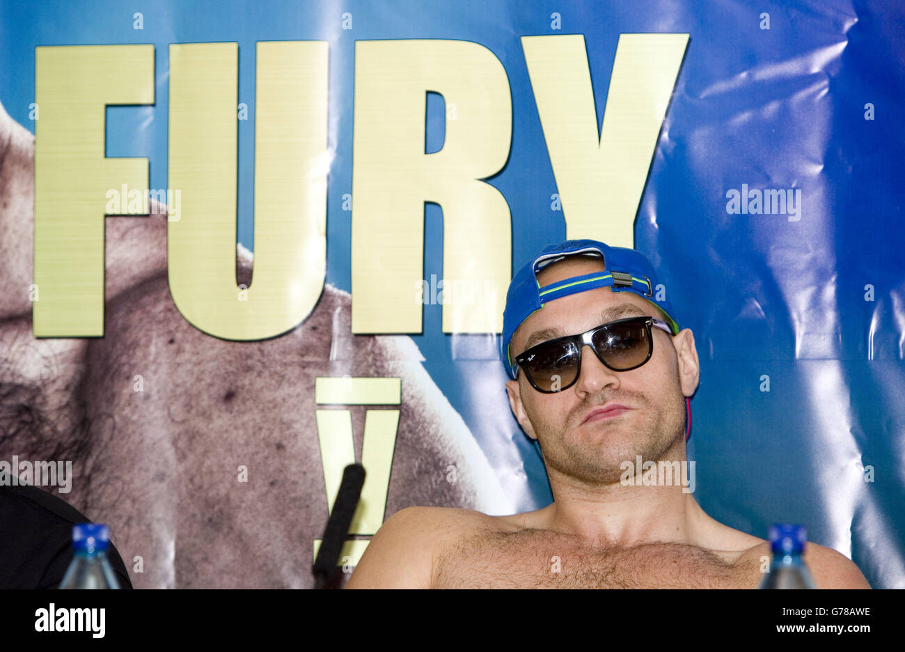 Tyson fury press conference at radisson blu hotel hi-res stock ...