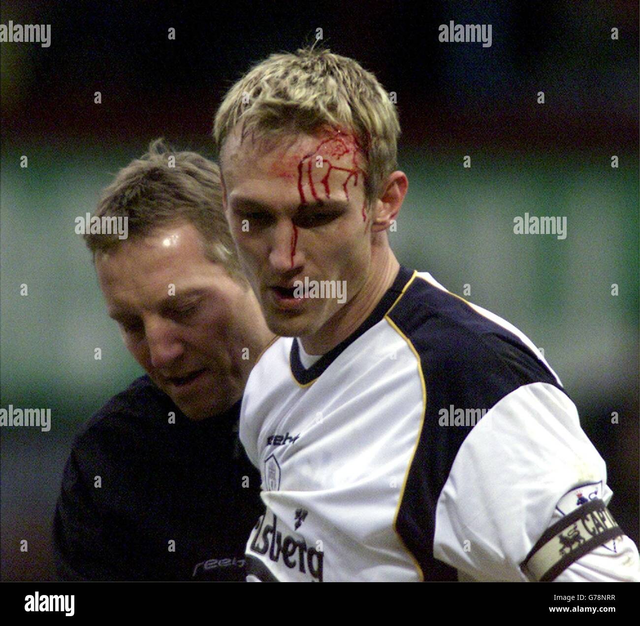 Injured blood football hi-res stock photography and images - Alamy