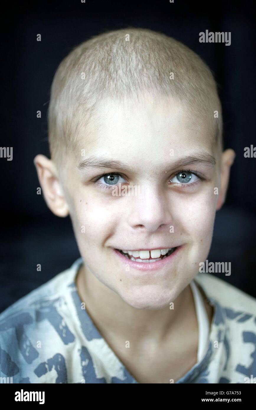 Joshua Hartley, the 12 year old diagnosed with X-Link Lymphoprolifera ...