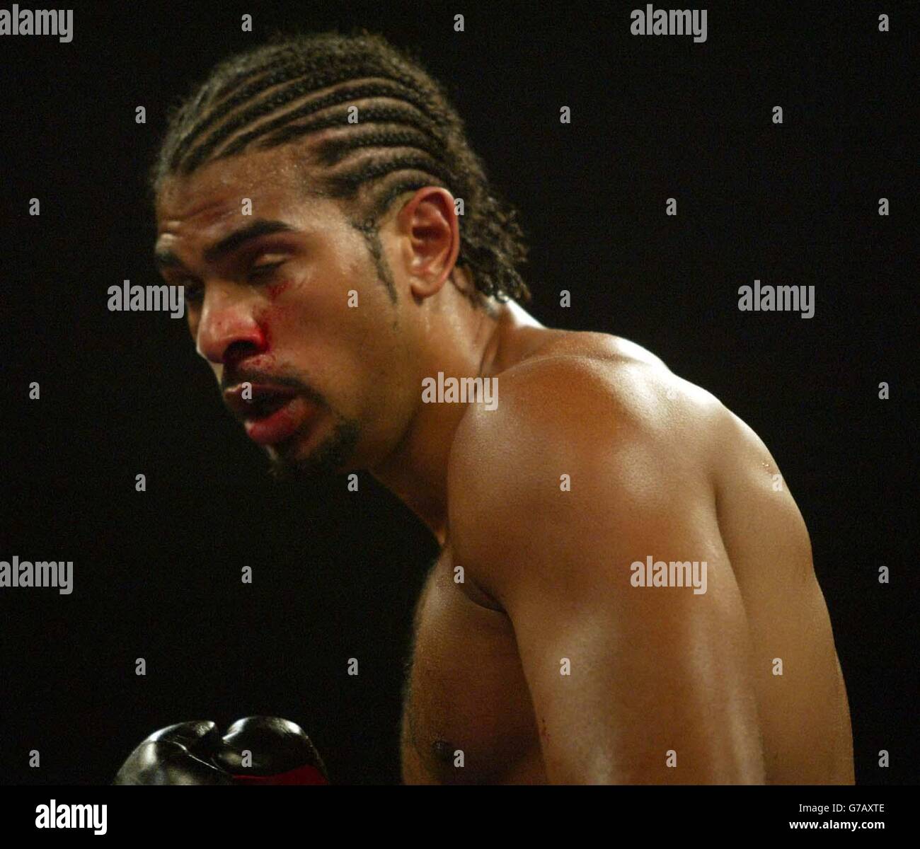David haye suffers cut during his fight against carl thompson hi-res ...