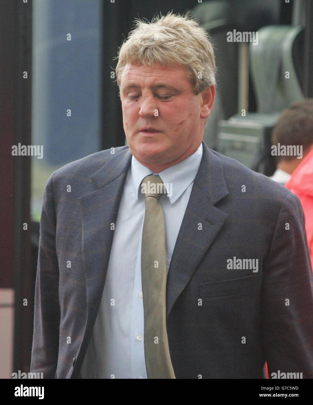 Steve Bruce cut cheek Stock Photo - Alamy