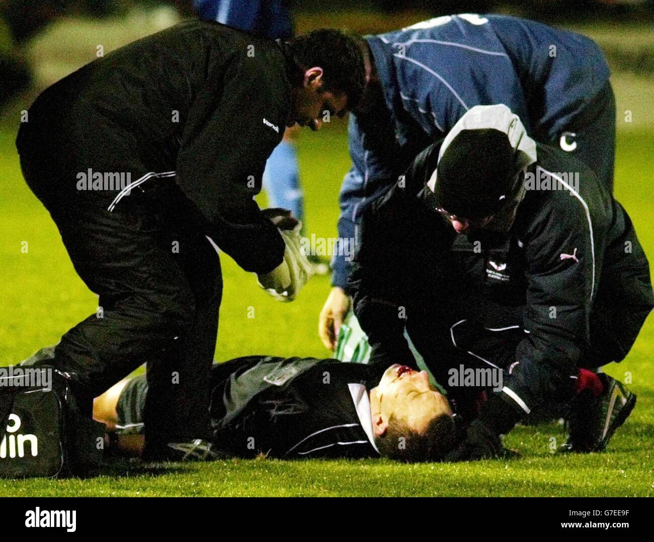 Football bleeding referee injury hi-res stock photography and images ...