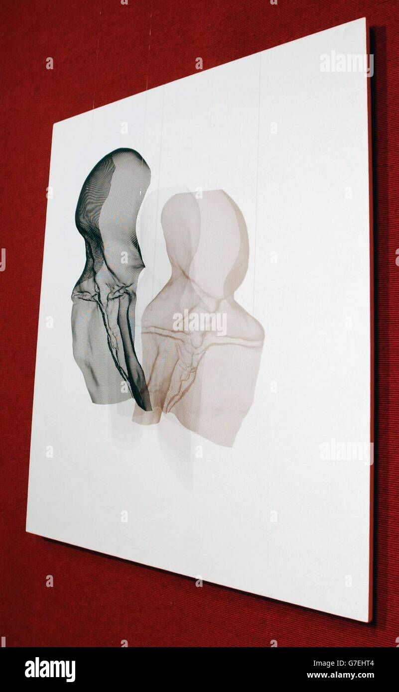 Artwork by David Begbie, entitled 'Skin Deep - 2004' which goes under ...