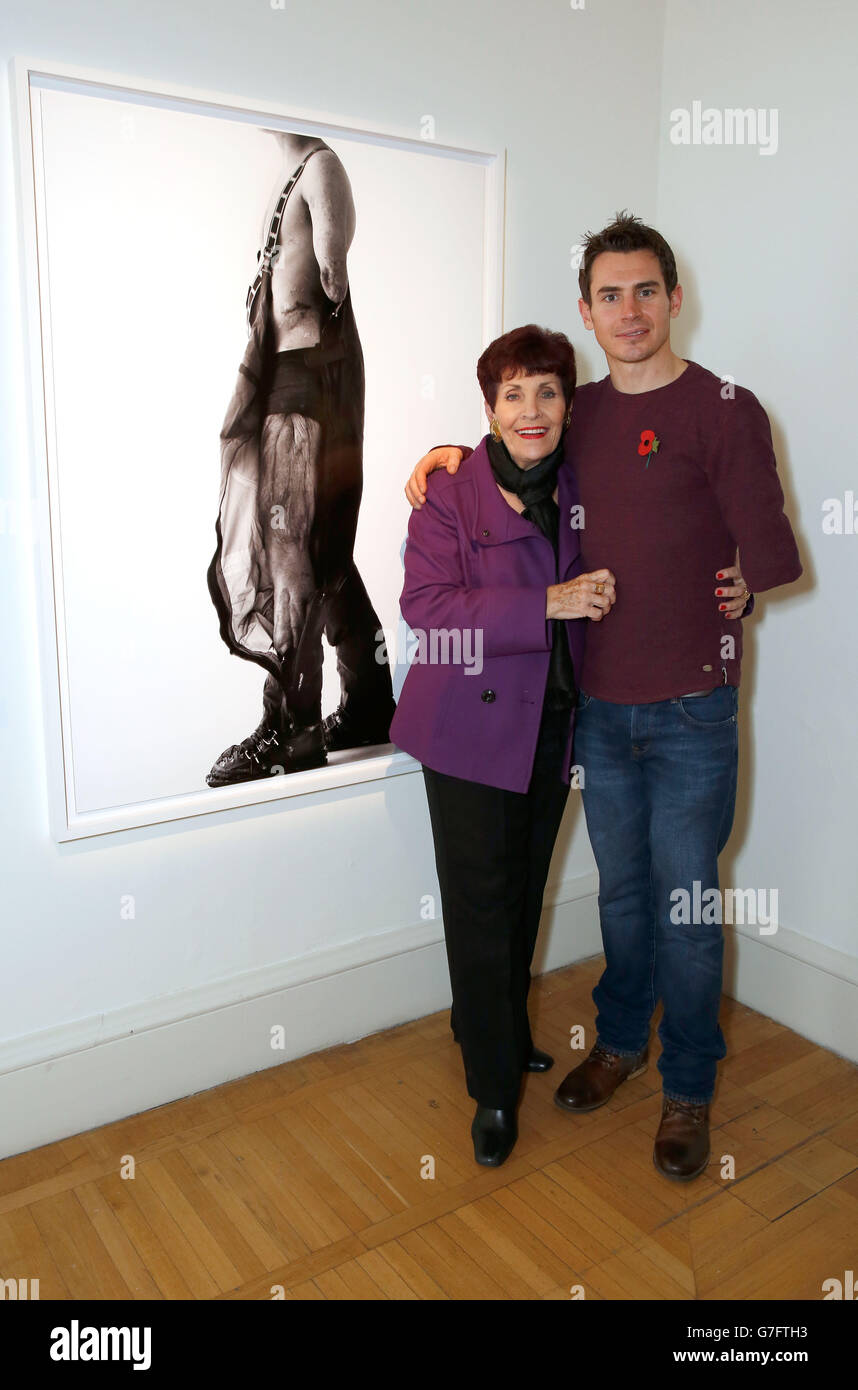 Ex-Serviceman Jaco Van Gass stands with his mother Aloma Van Gass ...