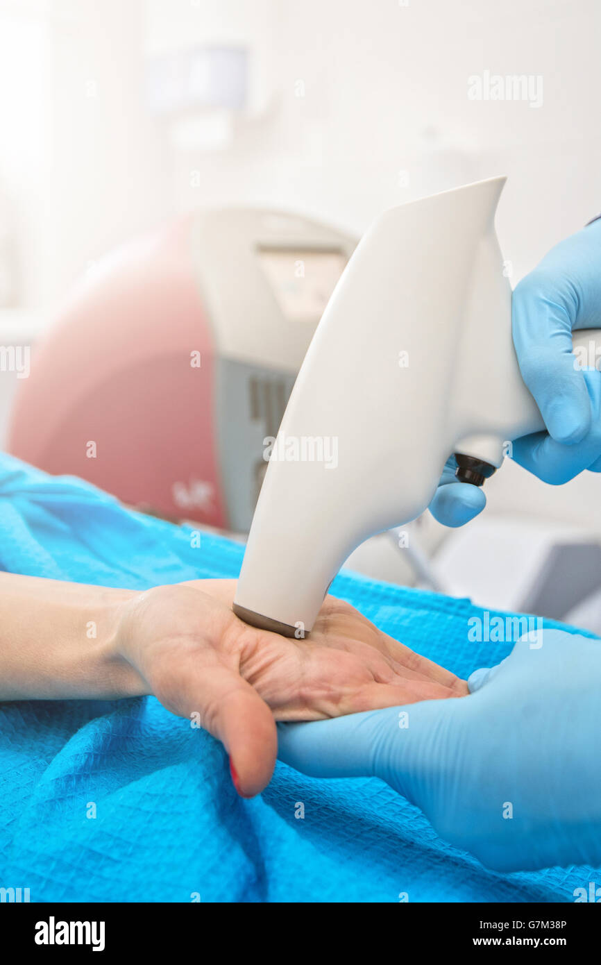 Procedure against hyperhidrosis Stock Photo - Alamy